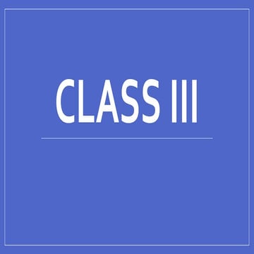 Class III, IV, V Cavity preparations for Composites- SELVI | PPTX