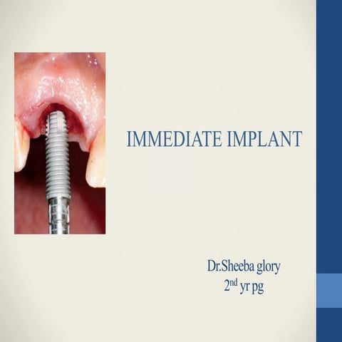 immediate implant | PPTX