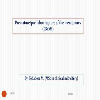 13. PROM premature rupture of membranes | PPTX
