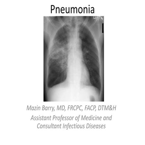 13-Community Acquired Pneumonia.ppt