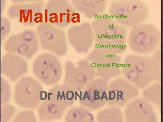 Malaria sem 6 students that are helpful for project report | PPT