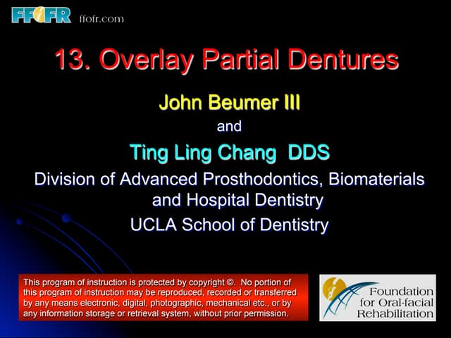 Impression Taking Components for Straumann | PDF