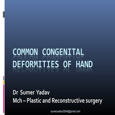 common congenital deformities of hand | PPT