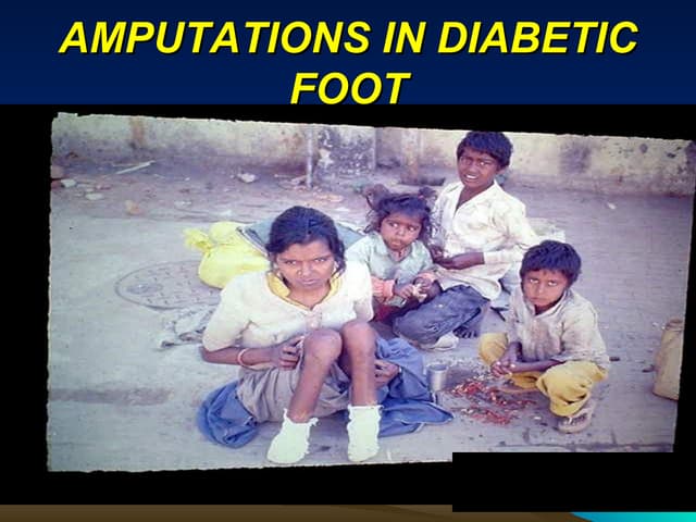 Pediatrics diabetic mellitus | PPT