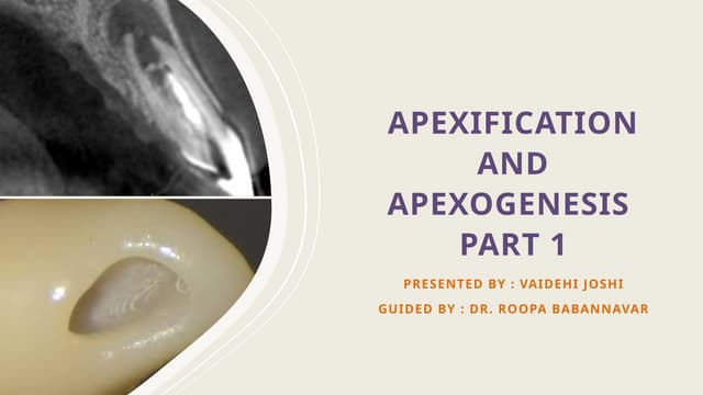Apexogenesis & apexification | PPTX
