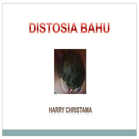Distosia Bahu final | PDF
