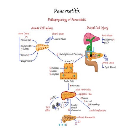 13• Pancreatitis [Illustrations Key].pdf