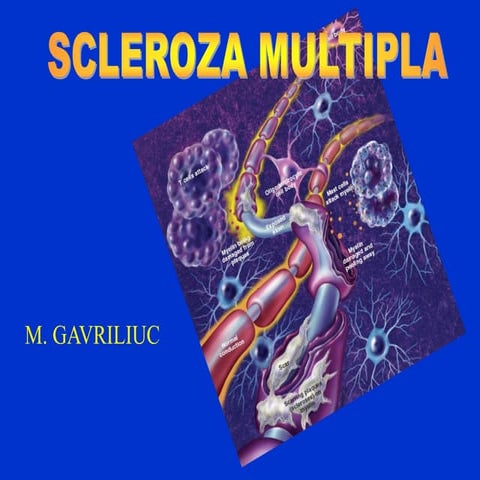 13 Scleroza Multipla.pdf