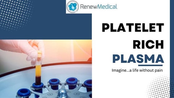 Platelet-Rich Plasma - A Rejuvenating Injection Therapy | PPT