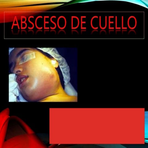 14. absceso de cuello | PPT