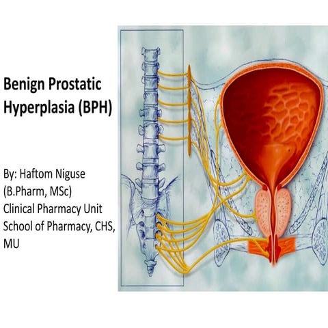 14. Benign prostatic hyperplasia.pptx