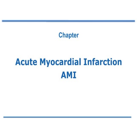 Ecg localization of myocardial infarction | PPTX
