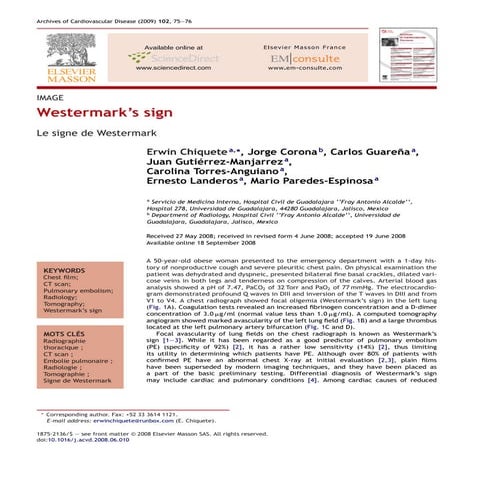 14. westermark's sign | PDF