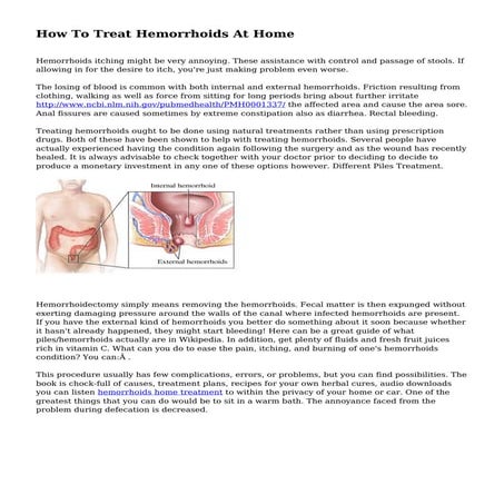 How To Treat Hemorrhoids At Home | PDF