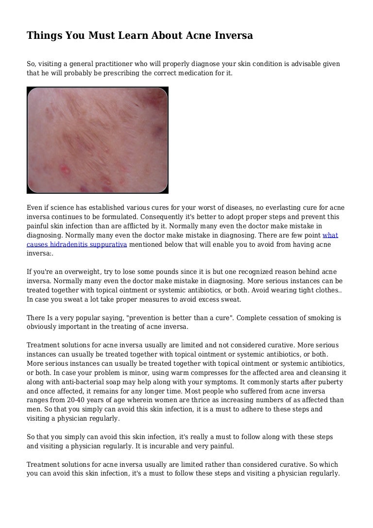 Things You Must Learn About Acne Inversa