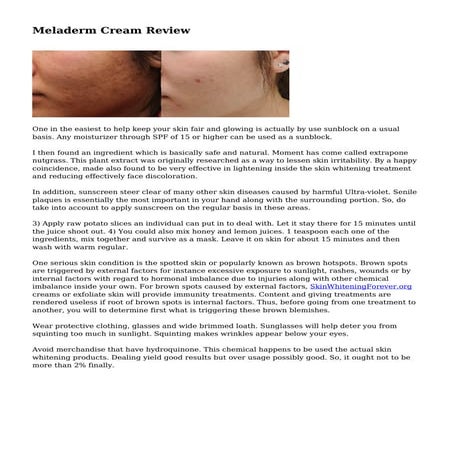Meladerm Cream Review | PDF