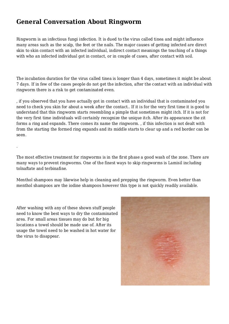 Ringworm Stages The Different Stages Of Ringworm Infection