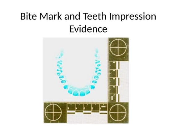 Bite Marks (FORENSIC DENTISTRY) | PPTX