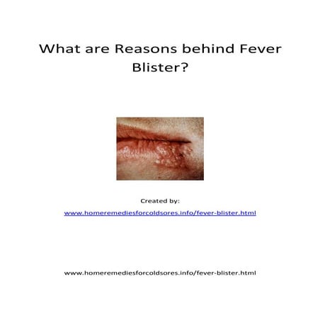 14 what are reasons behind fever blister | PDF | Infectious Diseases ...