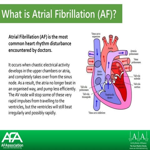 150317 What is AF? Slideshow | PPTX | Heart and Cardiovascular Diseases ...