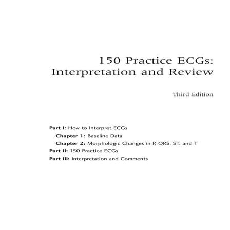 150 practice ECGs.pdf