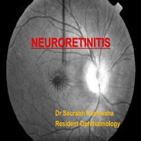 Clinical evaluation of optic disc changes | PPT