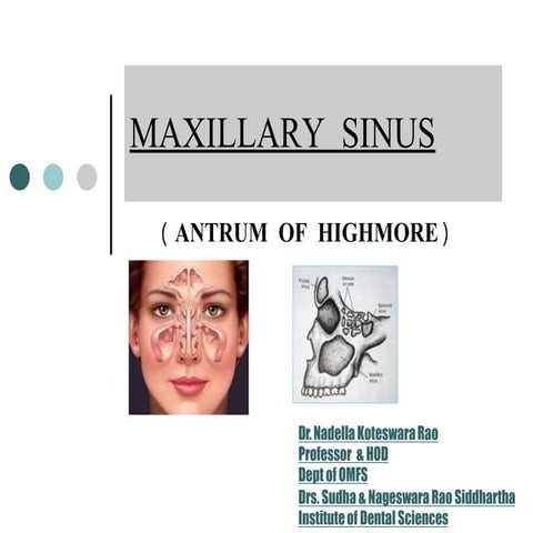 17. Maxillary sinus, antrum of highmore, surgical anatomy | PPTX