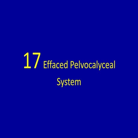 17 effaced pelvocalyceal system | PPT