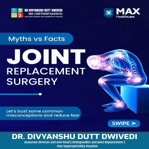 Myths vs Facts – Joint Replacement Surgery | PDF