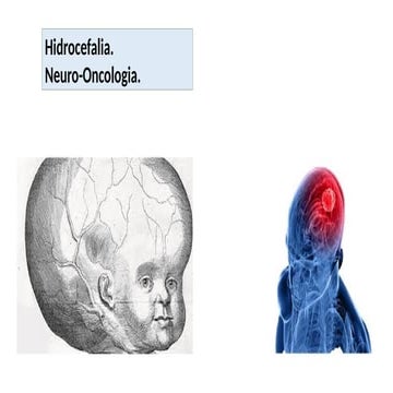 diabetic foot surgery approach diagnosis and tto.pptx