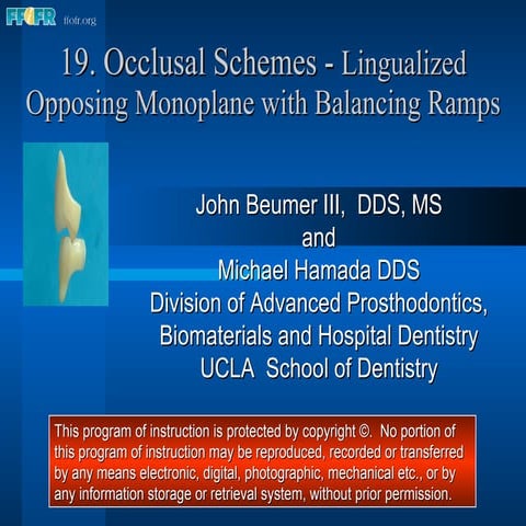 Complete dentures 16.occlusal schemes lingualized occlusion | PDF