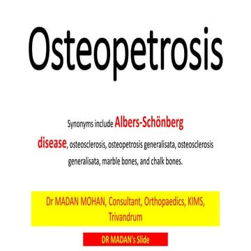 191019 osteopetrosis | PPTX
