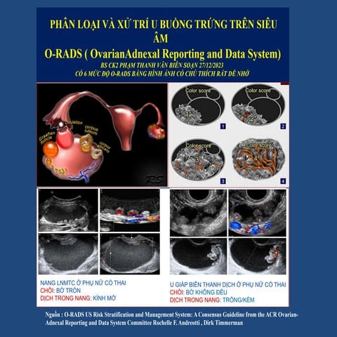 O-RADS 27-12-2023 Phan tang u buong trung.pptx