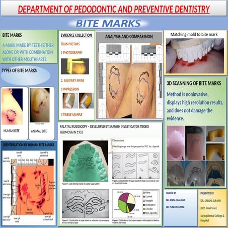 BITE MARKS IN FORENSIC DENTISTRY POSTER. | DOCX