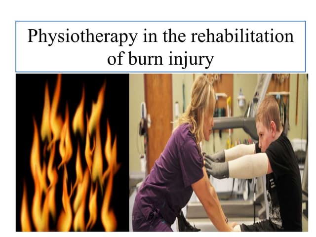 1 Burn Rehablitation Pptx