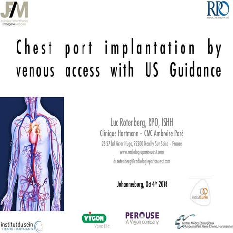 Chest port implant access and techniques. Luc Rotenberg 2018 | PDF