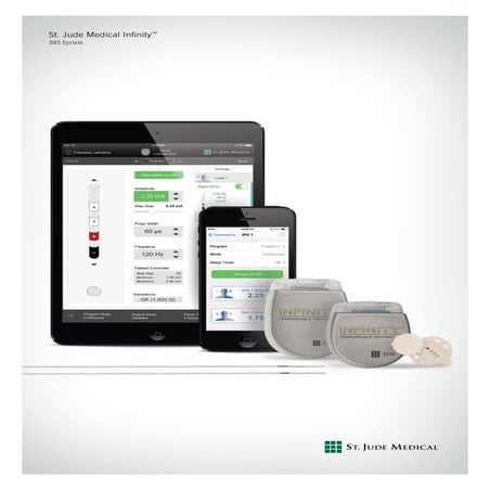 Infinity DBS System | PDF