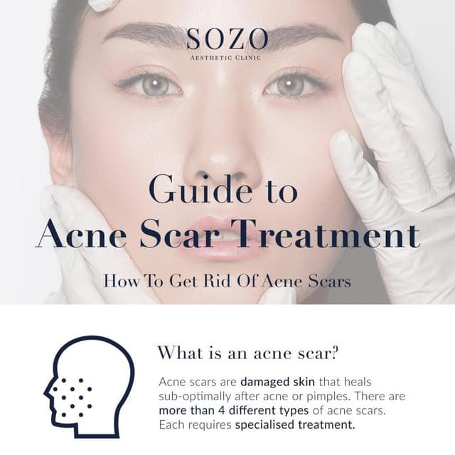 Guide to acne scar treatment | PDF