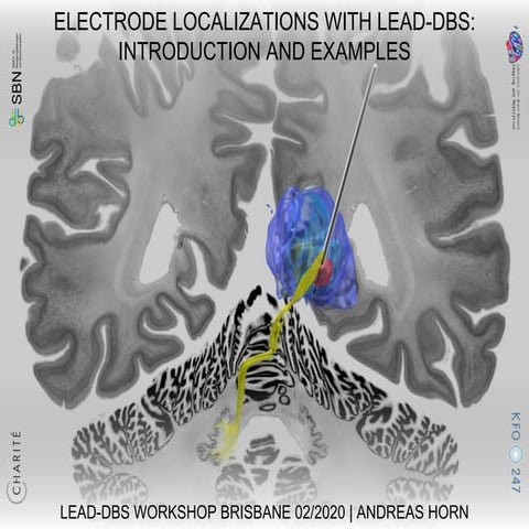 Introduction to Lead-DBS | PPT