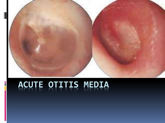 Otitis Externa Furuncle The Prevalence Of Various Eyelid Skin Lesions