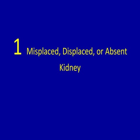 1 misplaced, displaced, or absent kidney | PPTX