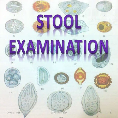 1 stool general 19 | PPTX | Chemistry | Science