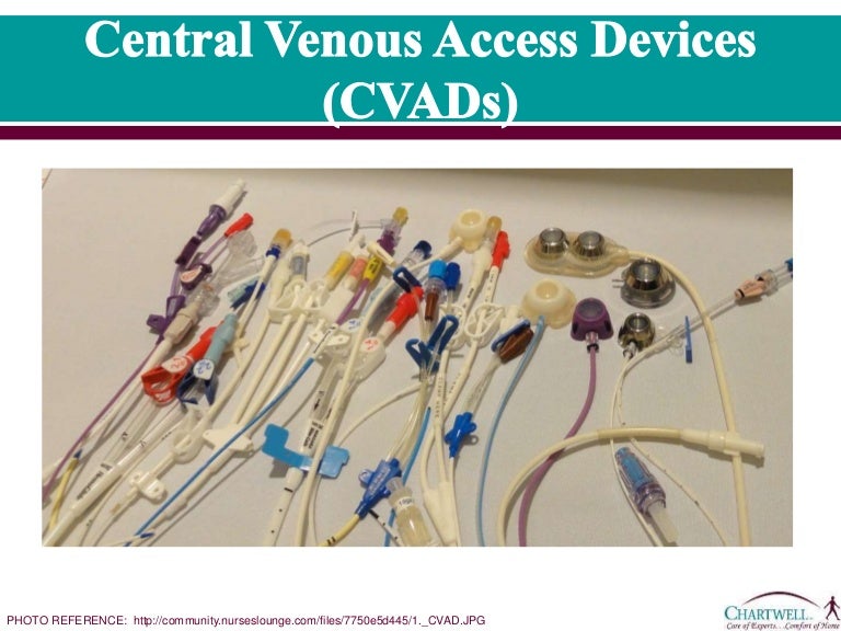 2. central venous access devices (cvads)