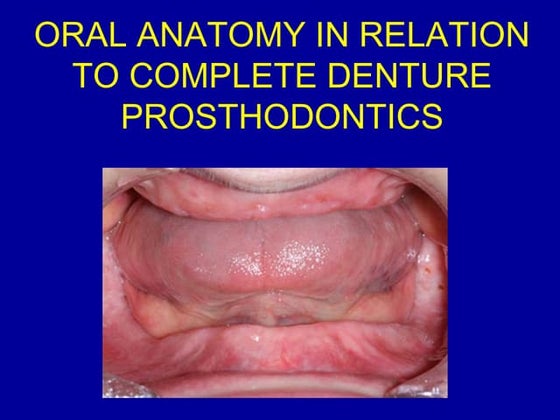 Anatomical landmarks of edentulous maxillary arch | PPTX