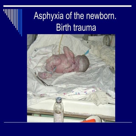 Asphyxia of the newborn. Birth trauma | PPT