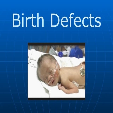 Congenital malformations | PPTX