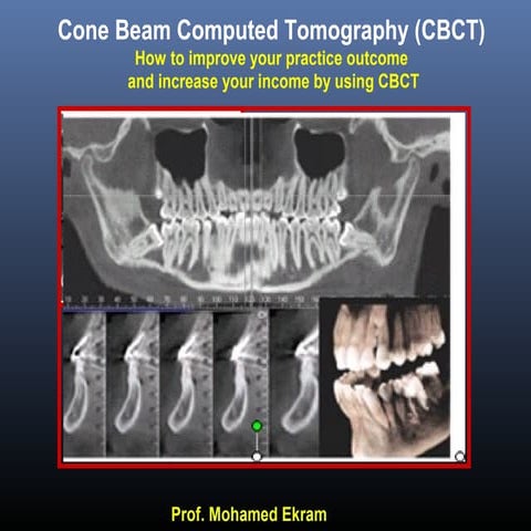 Basic applications of CBCT | PPT | 3-D Graphics | Computer Software and ...