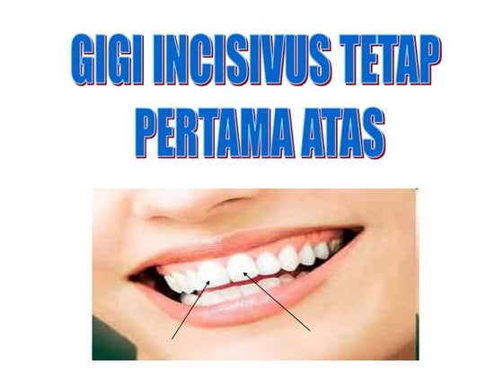 3. anatomi gigi insisivus kedua atas & bawah | PPT