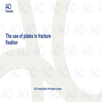 Orthopaedic Plates - types and applications | PPTX