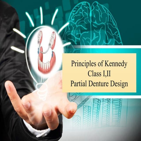 Cast partial denture design | PDF